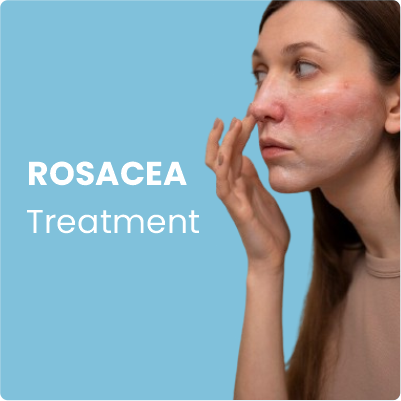 Rosacea Treatment - MedsBase.com